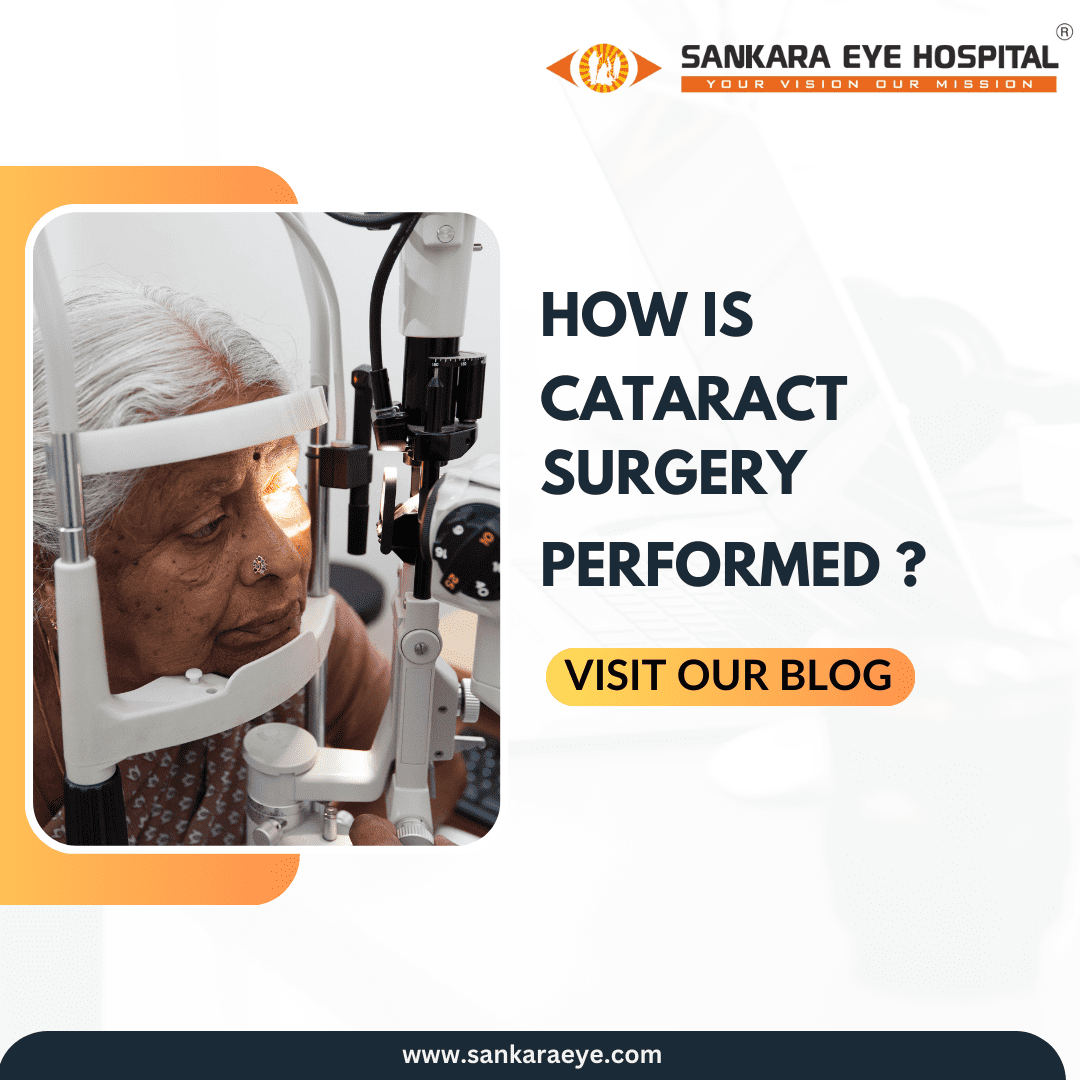 How is cataract operation performed